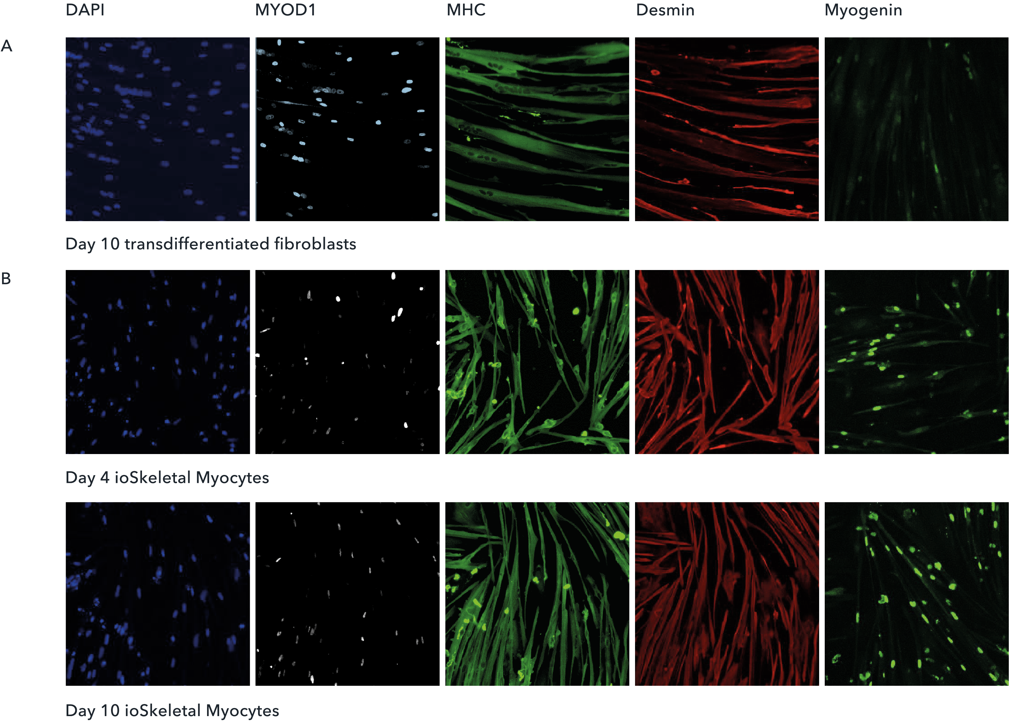 Skeletal Myocytes | ioCells