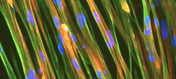 Research in Motion with ioSkeletal Myocytes