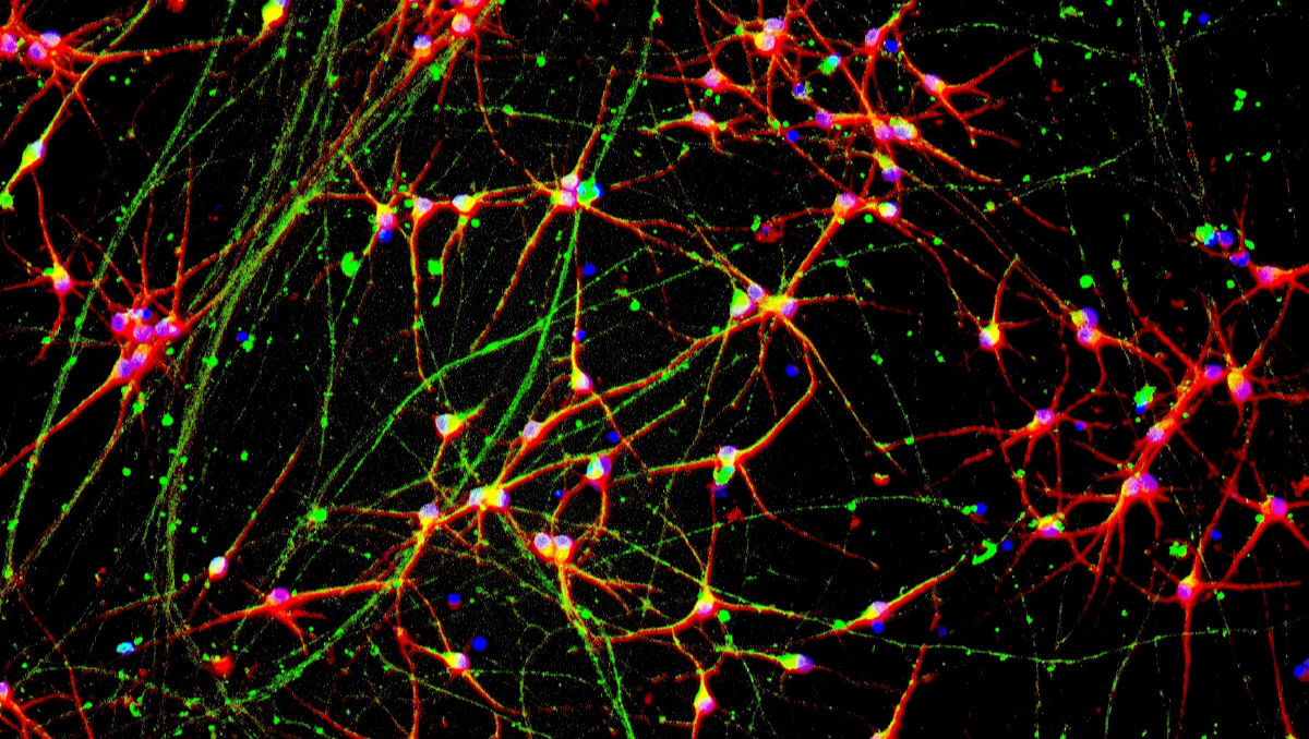 Human iPSC-derived neurons | bit.bio