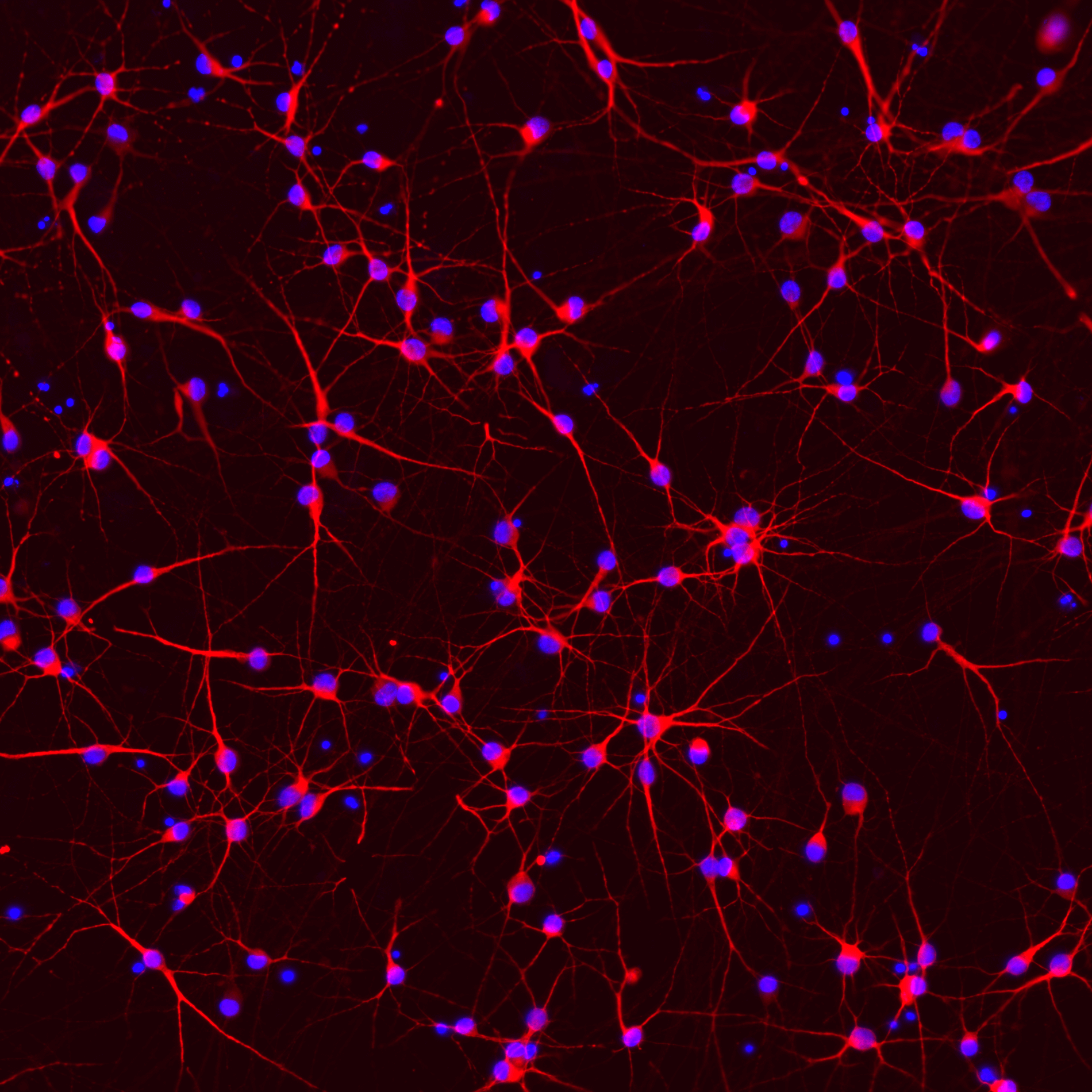 Human Disease Model Cells with Isogenic Controls | ioCells | bit.bio