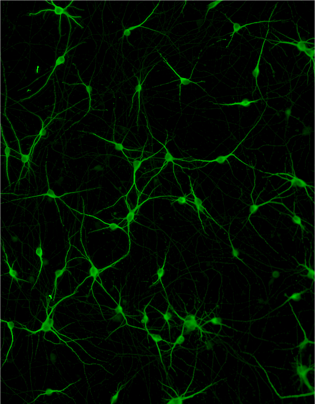 Motor Neurons SOD1 G93A/WT | ioCells