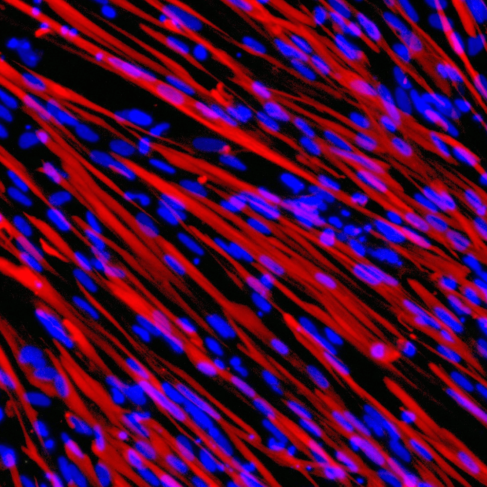 Skeletal Myocytes DMD Exon 44 Deletion | ioCells