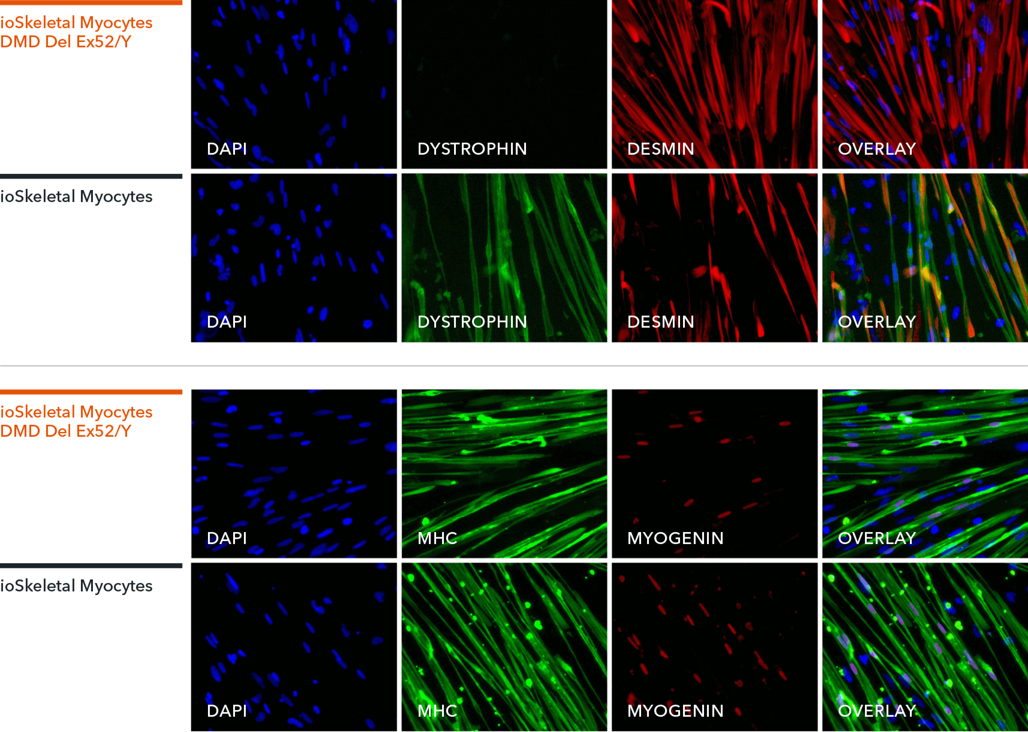 Skeletal Myocytes DMD Exon 52 Deletion | ioCells