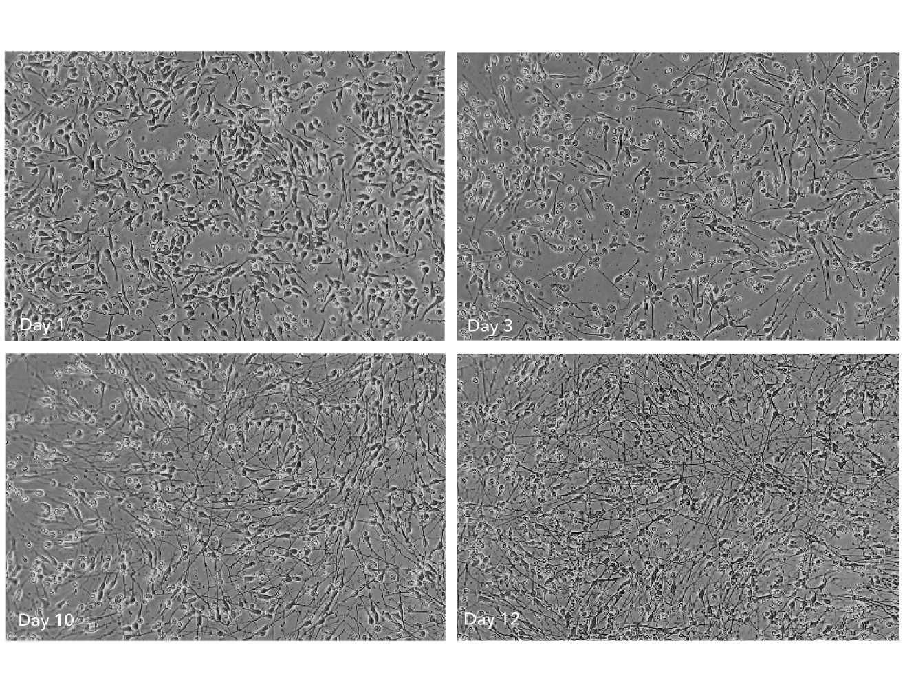 4 top tips for culturing iPSC-derived GABAergic Neurons