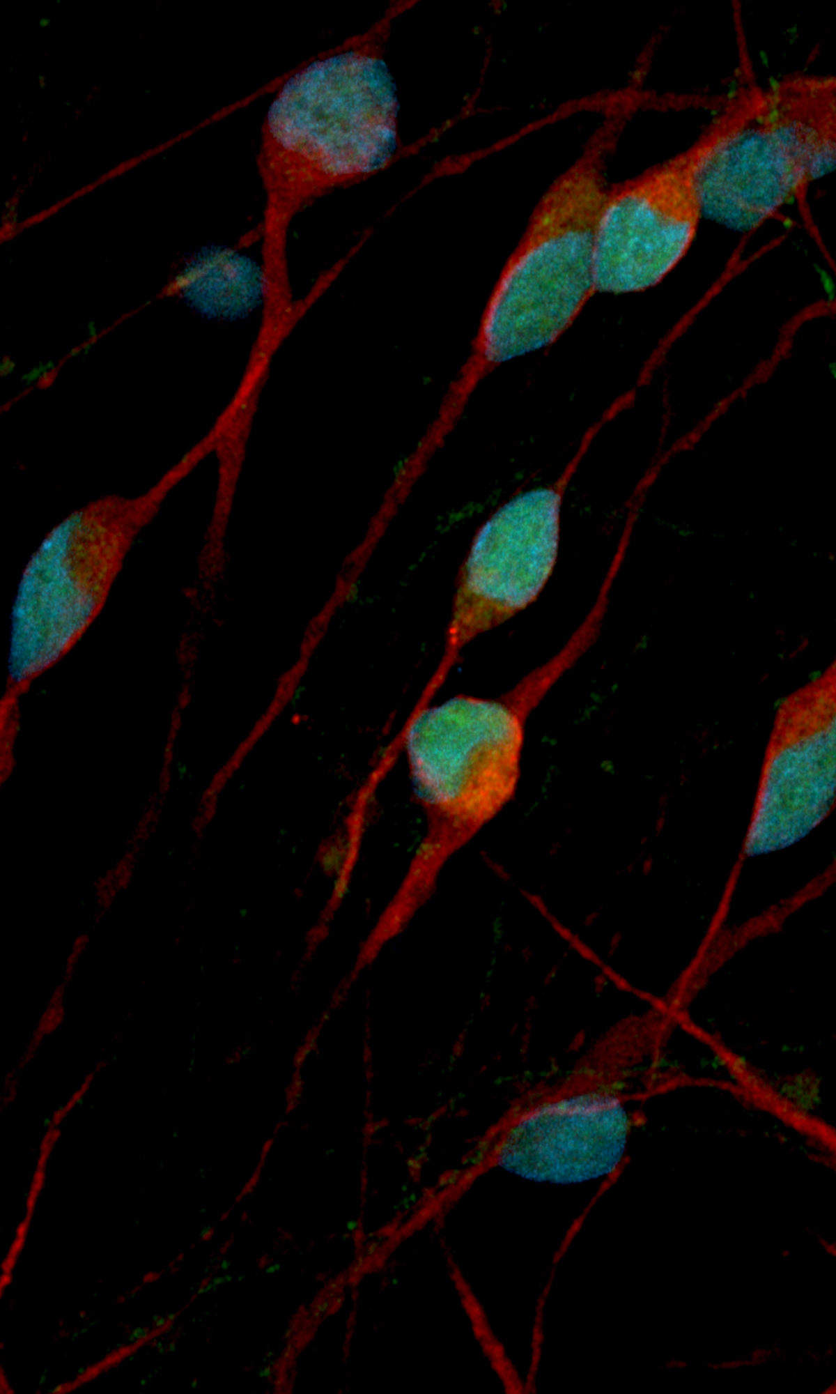 GABAergic Neurons | ioCells