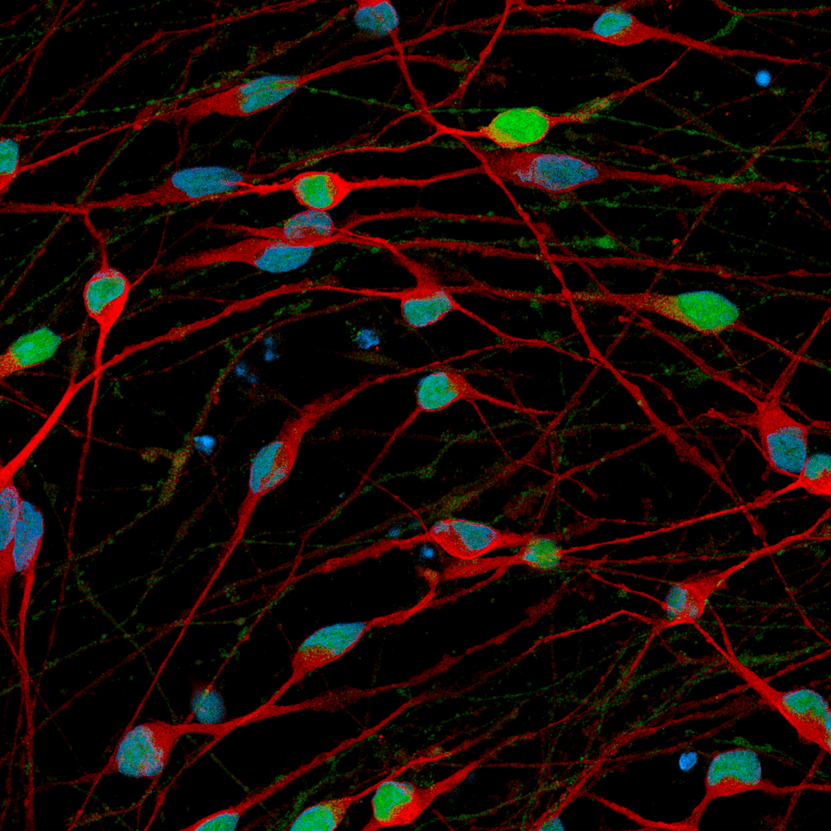 GABAergic Neurons | ioCells