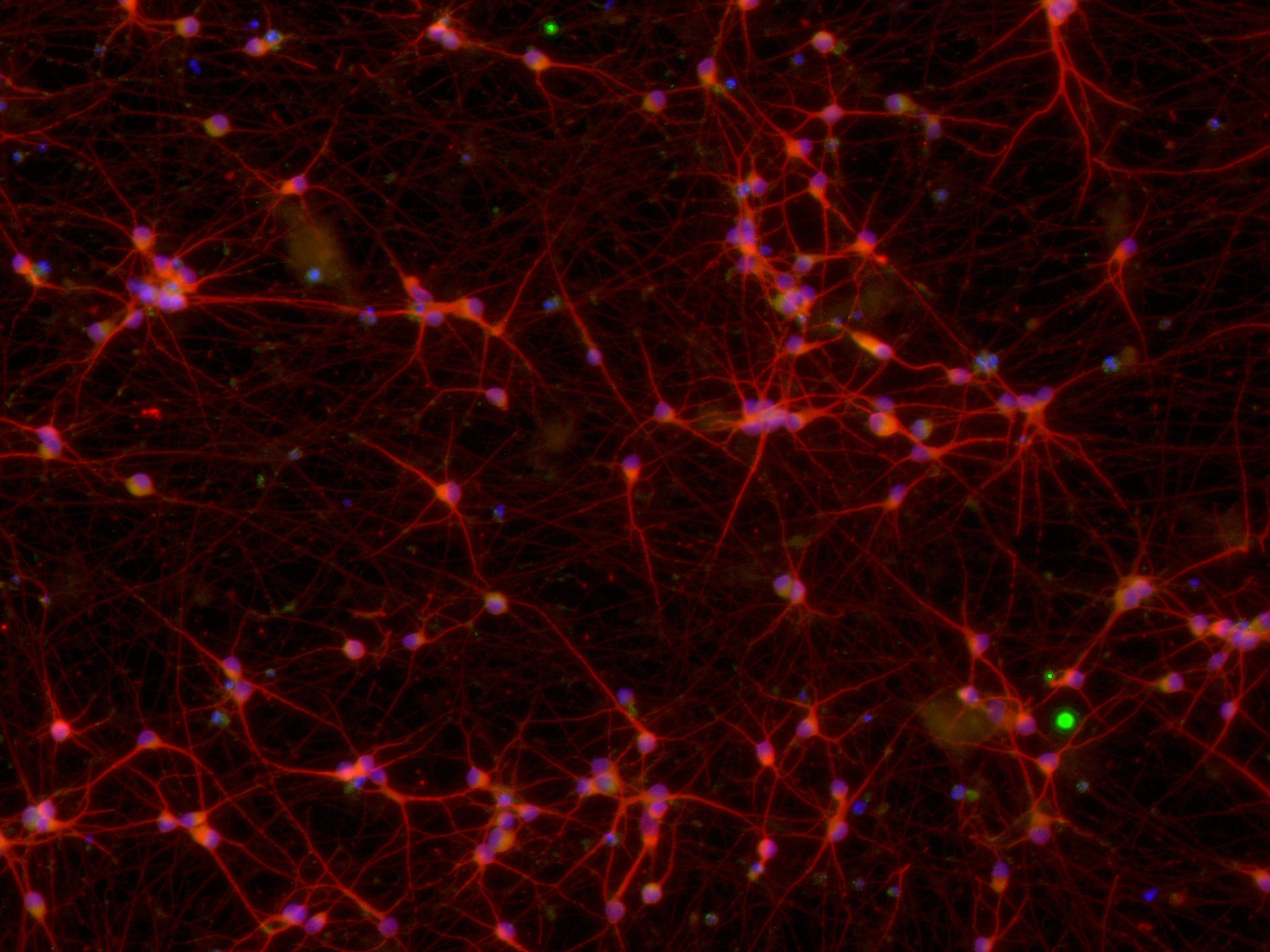 Modelling ALS and FTD with iPSC-derived Neurons | ioCells | bit.bio