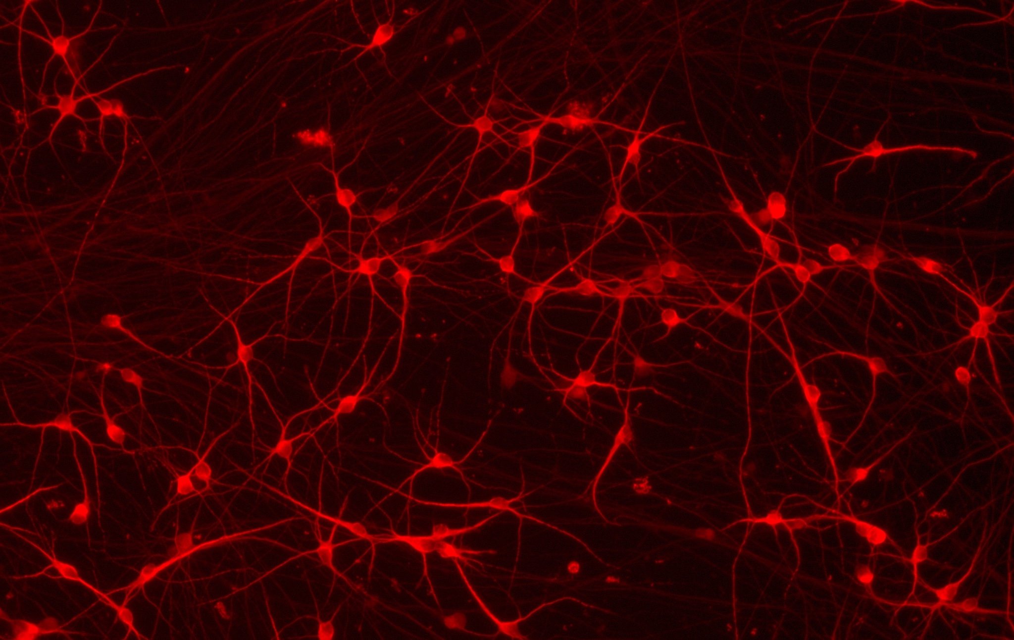 CRISPR-Cas9 knockout screen in iPSC-derived Neurons identifies new ...
