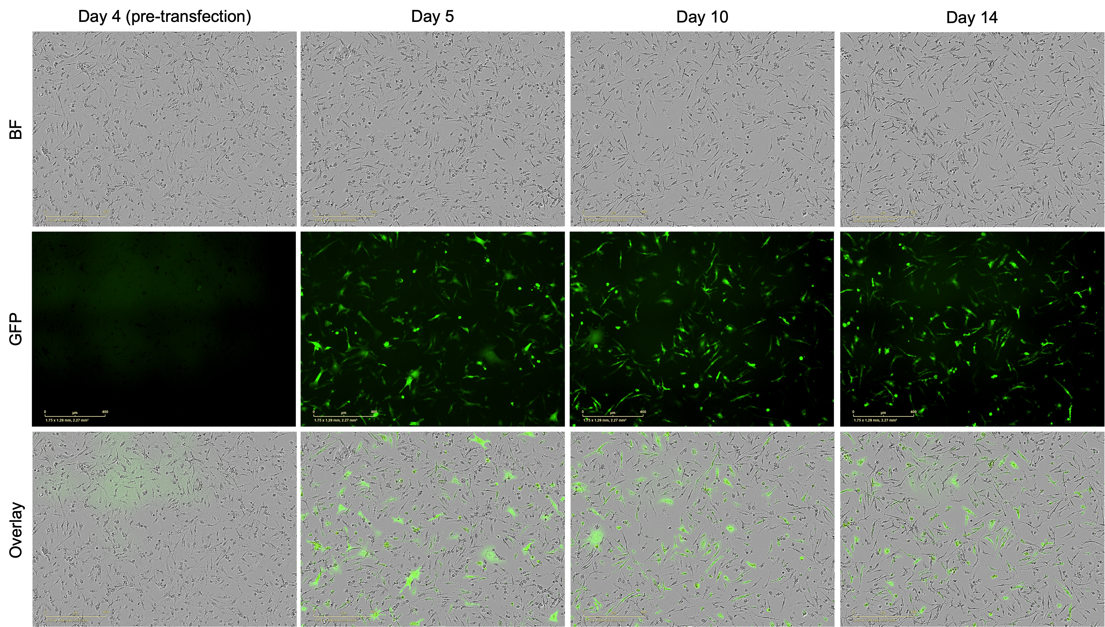 glial cells coloring page