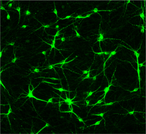 Human iPSC-derived neurons | bit.bio