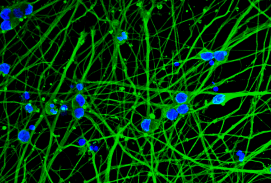 Glutamatergic Neurons HTT 50CAG/WT | ioCells