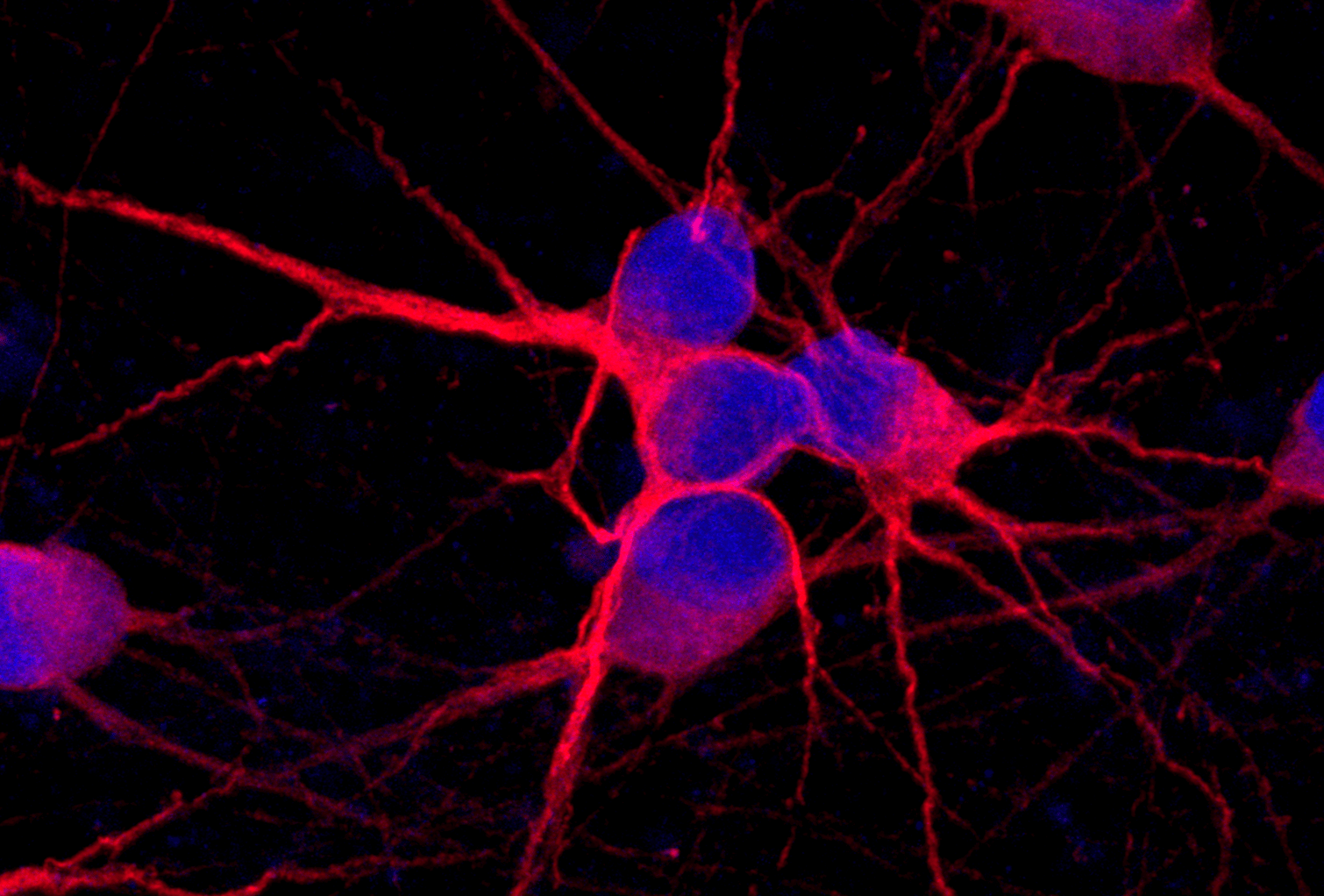 Oligodendrocyte-like cells | ioCells