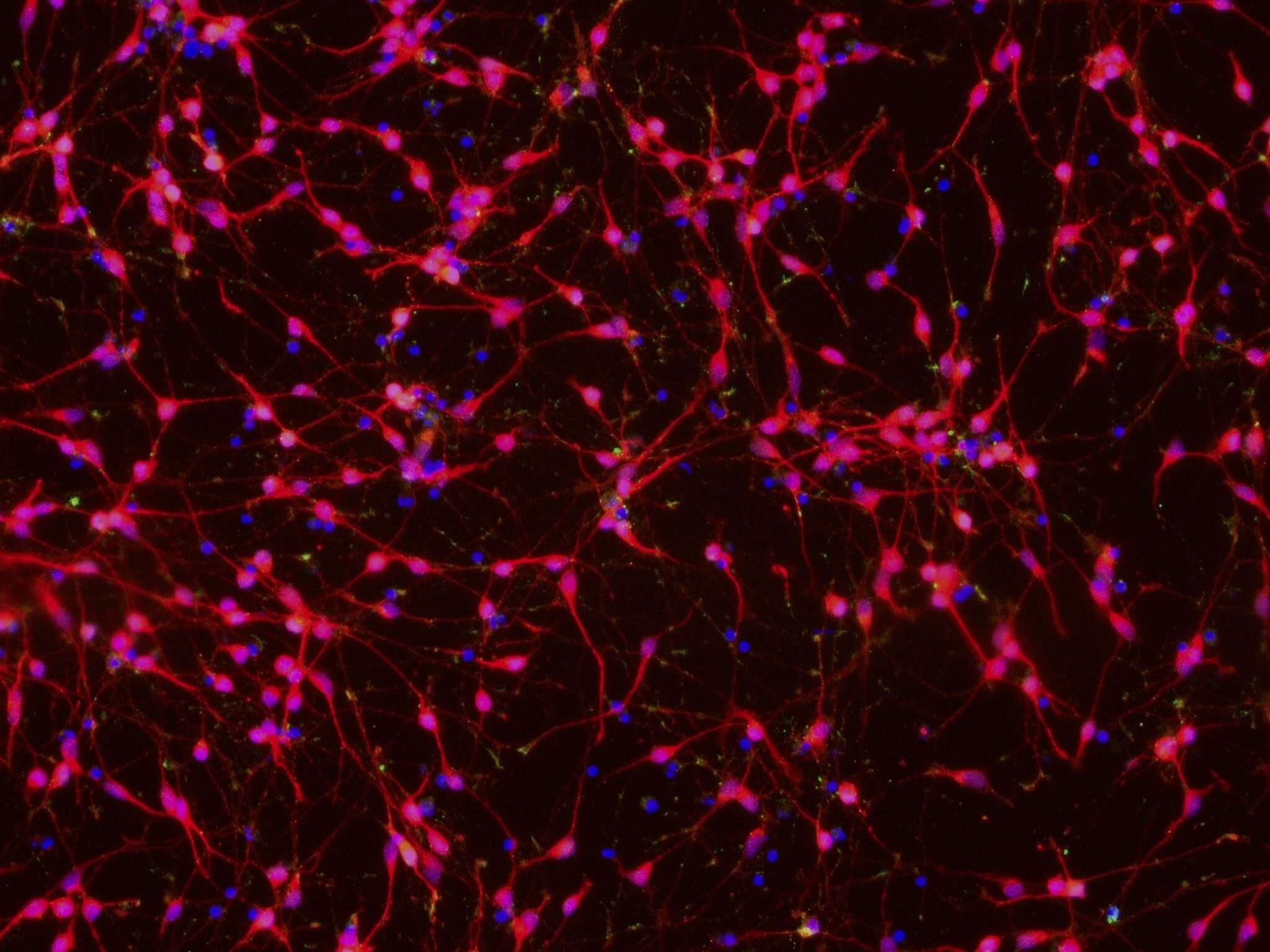 Modelling Alzheimer's with iPSC-derived Neurons | ioCells | bit.bio