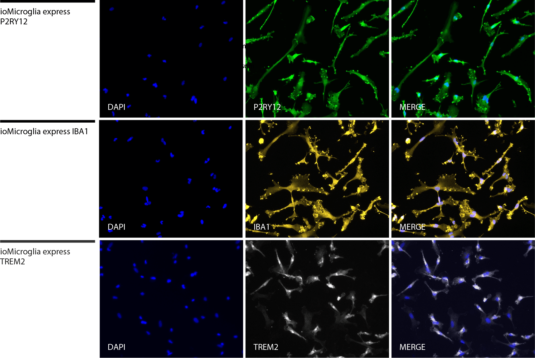 Microglia | Female | ioCells