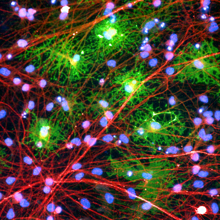 Progress in applying human iPSC-derived cells to drug discovery