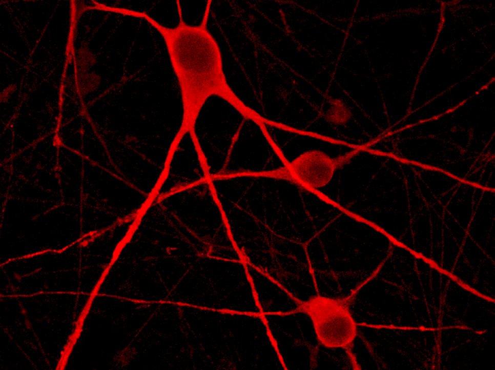 MEA Co-culture | ioMotor Neurons & rat astrocytes protocol
