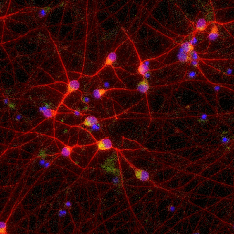 Glutamatergic Neurons TDP‑43 M337V/M337V | ioCells