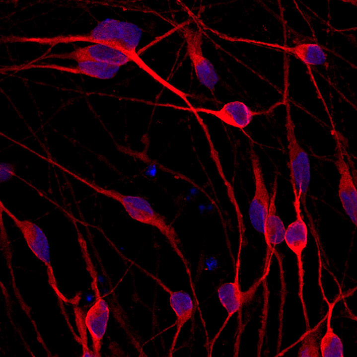 Alzheimer's disease models | bit.bio