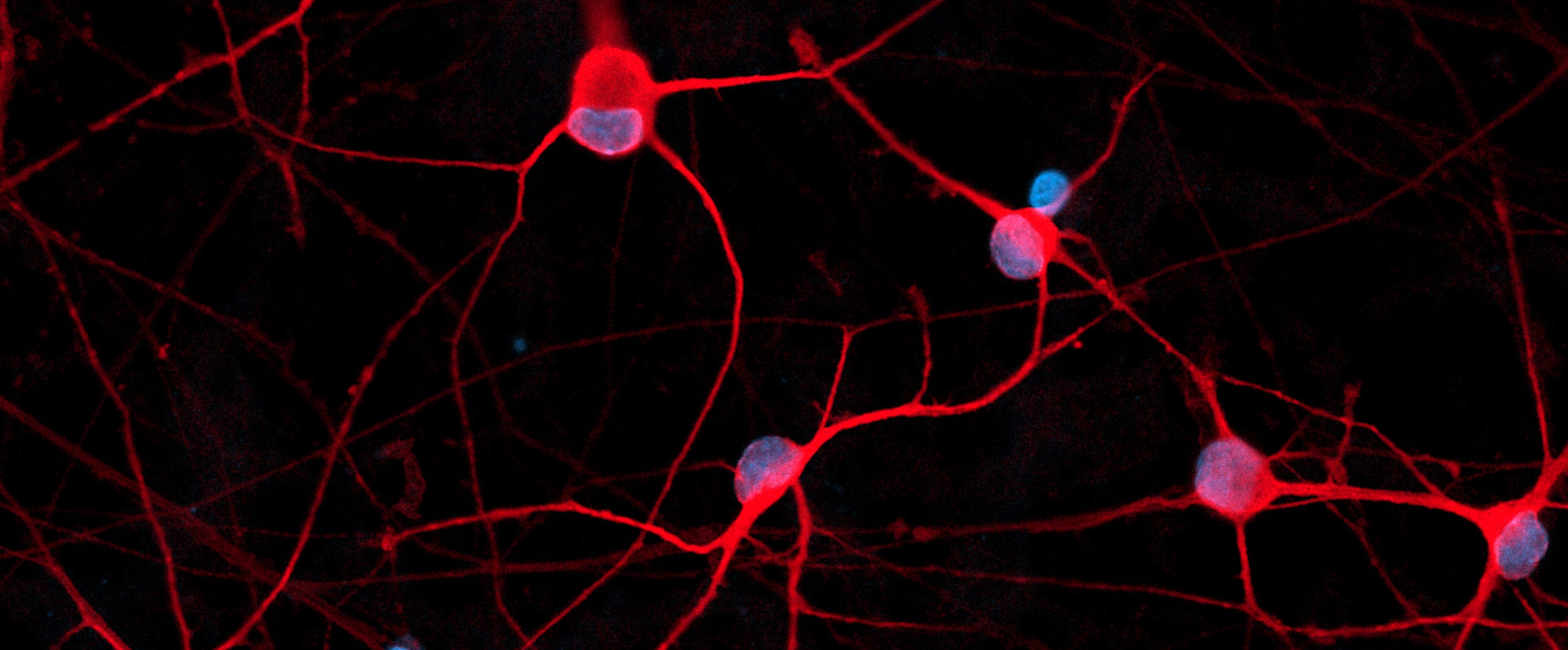 Mastering Cell Identity In A Dish: The Power Of Cellular Reprogramming
