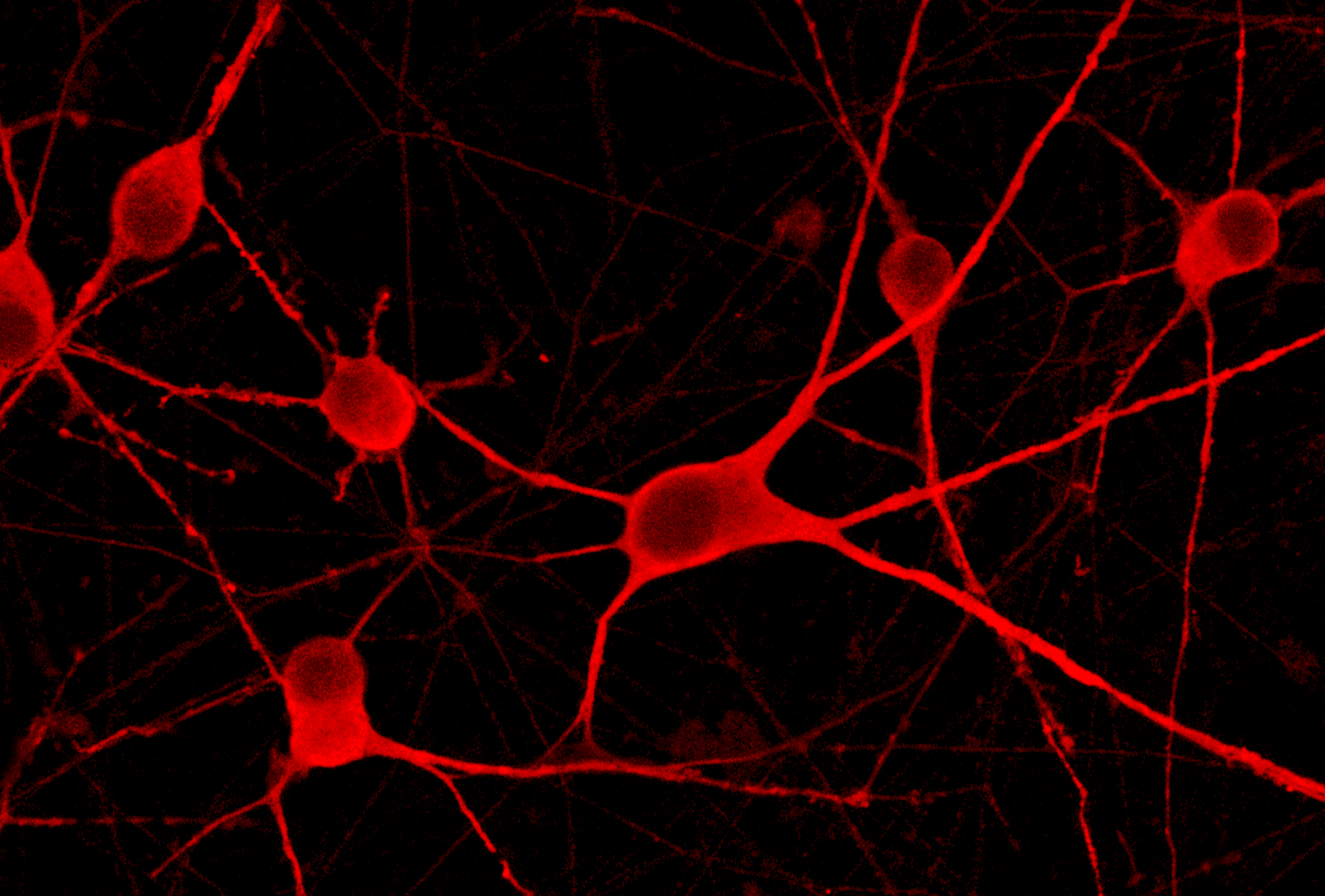 Empowering motor neuron disease research and drug discovery with a new ...
